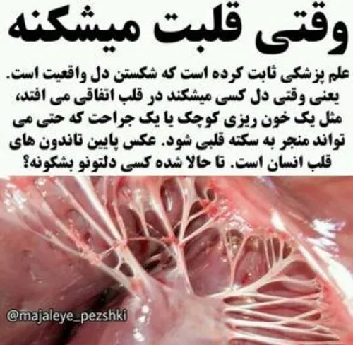 عکس قلب انسان واقعی شکسته عکس نودی